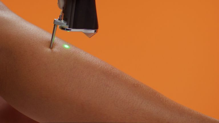 Advantages of laser systems - El.En. Group